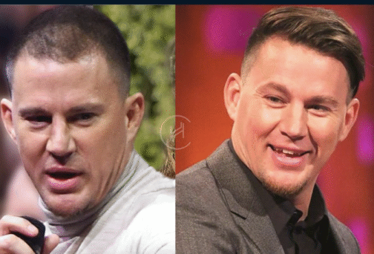How They Looked: Famous Bald Celebs Before Going Bald